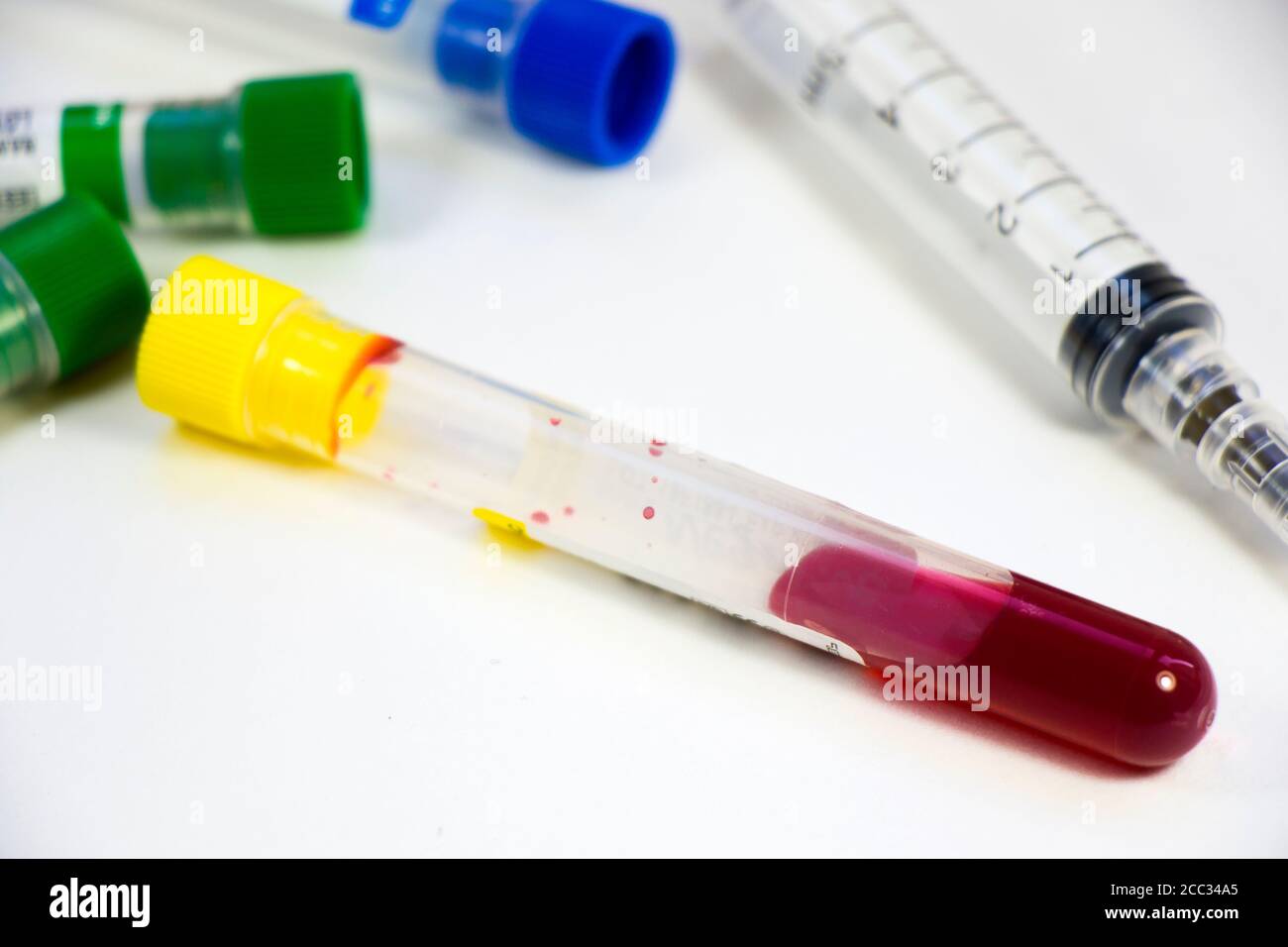 Instruments de laboratoire chimique, verrerie et pipette. Tests et ...