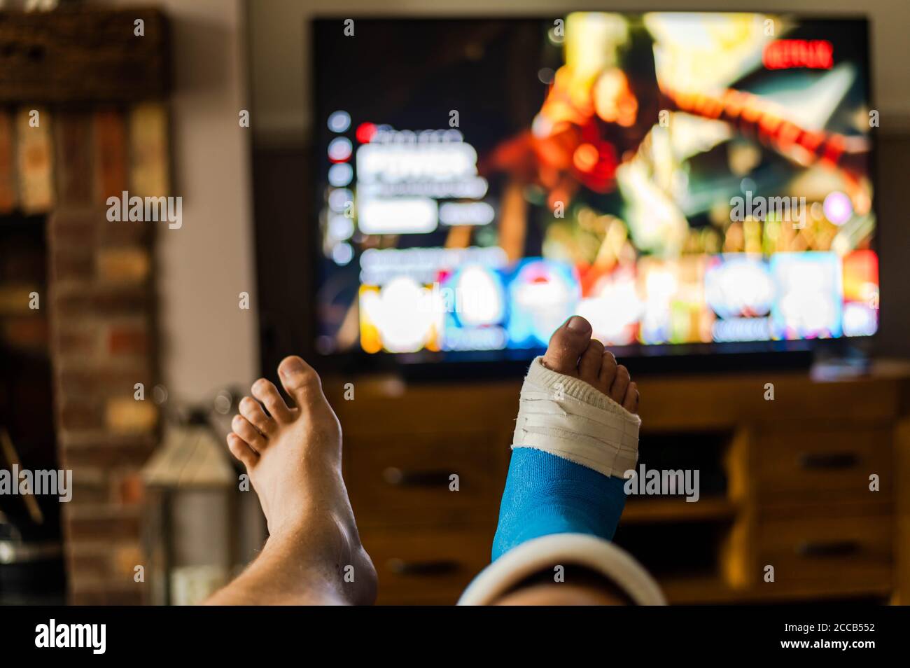 Metatarsal fracture Banque de photographies et d’images à haute ...