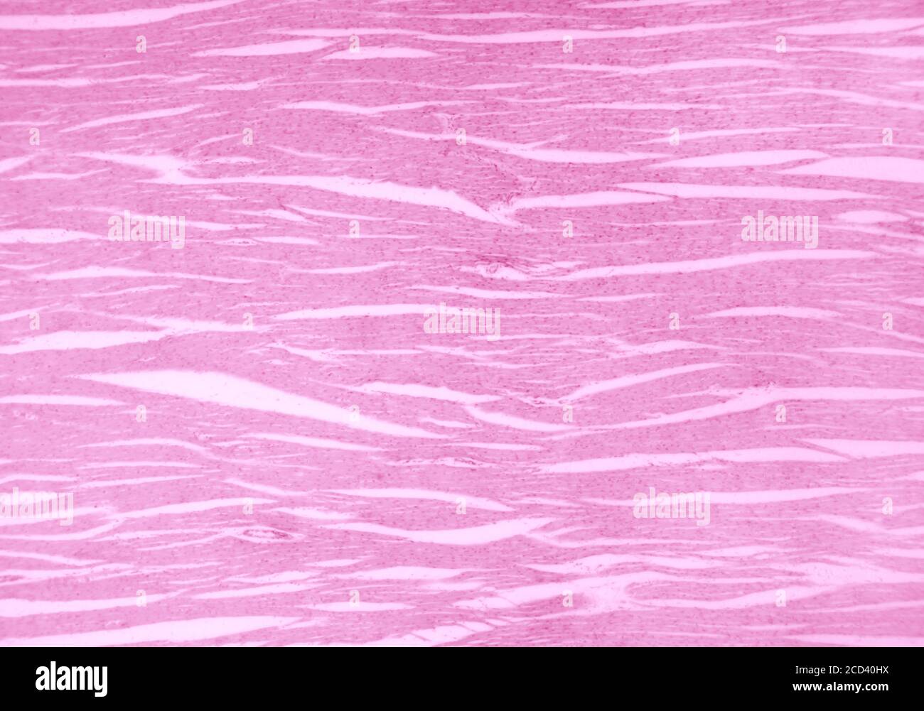 Section de muscle cardiaque sous microscope léger. Muscle cardiaque ...