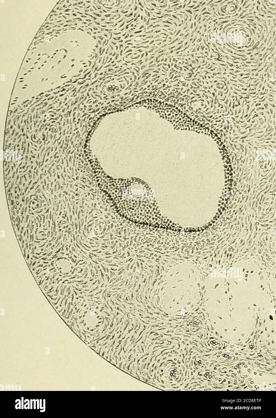 . Gynécologie : . a été soméquestion quant à l'origine des cellules qui ...