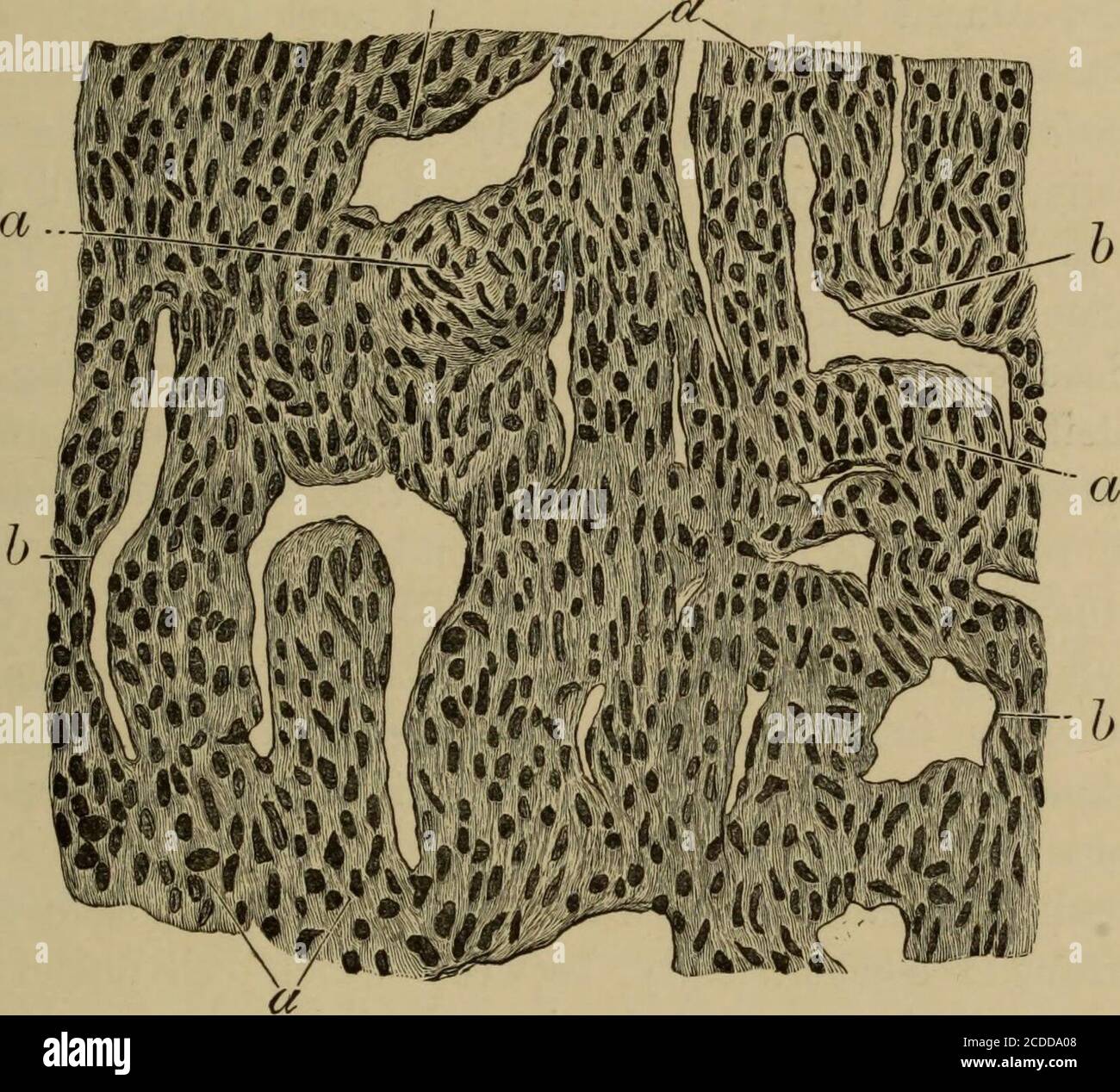 . Les éléments de l'histologie pathologique avec une référence spéciale ...