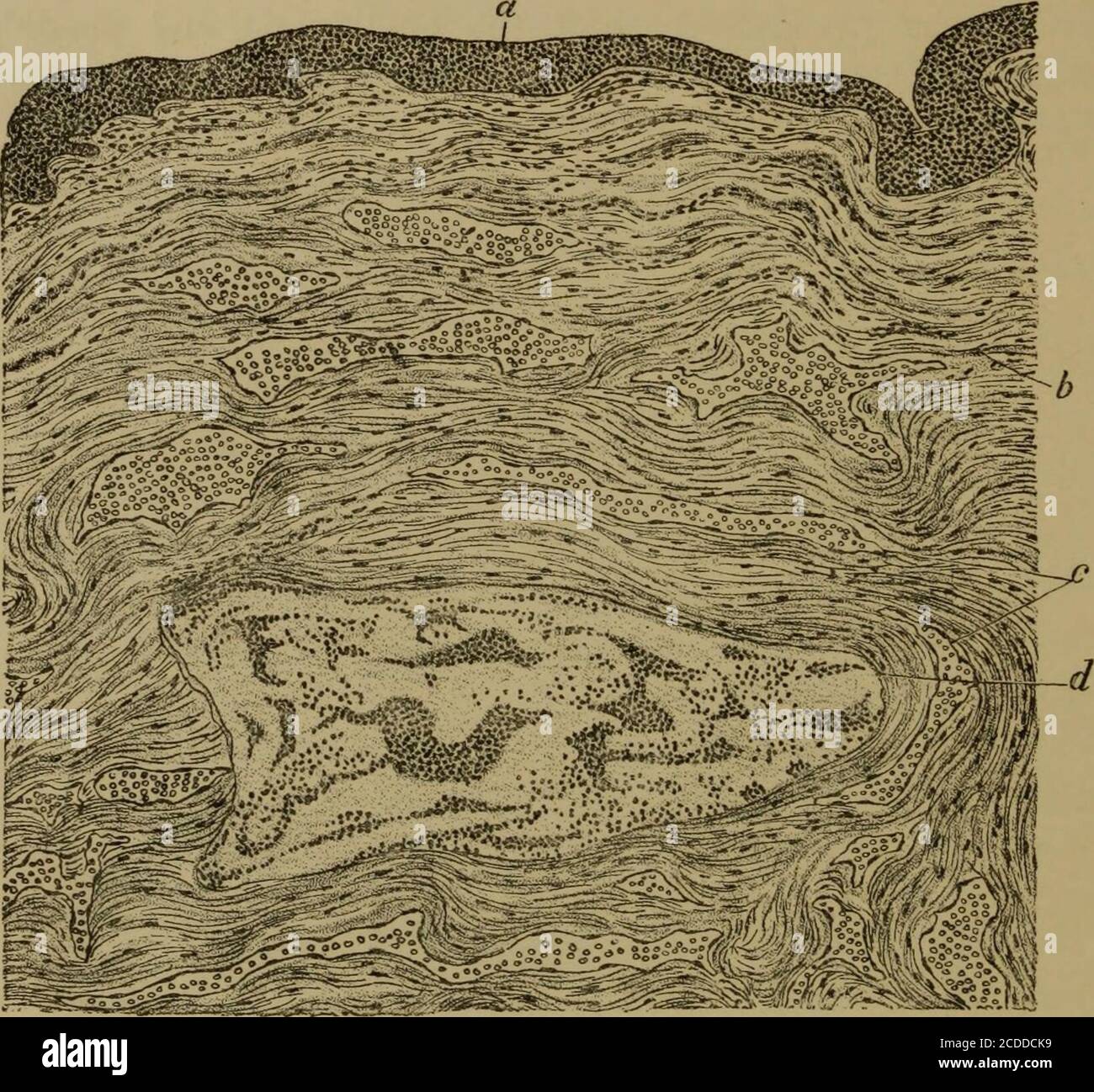 . Les éléments de l'histologie pathologique avec une référence spéciale ...