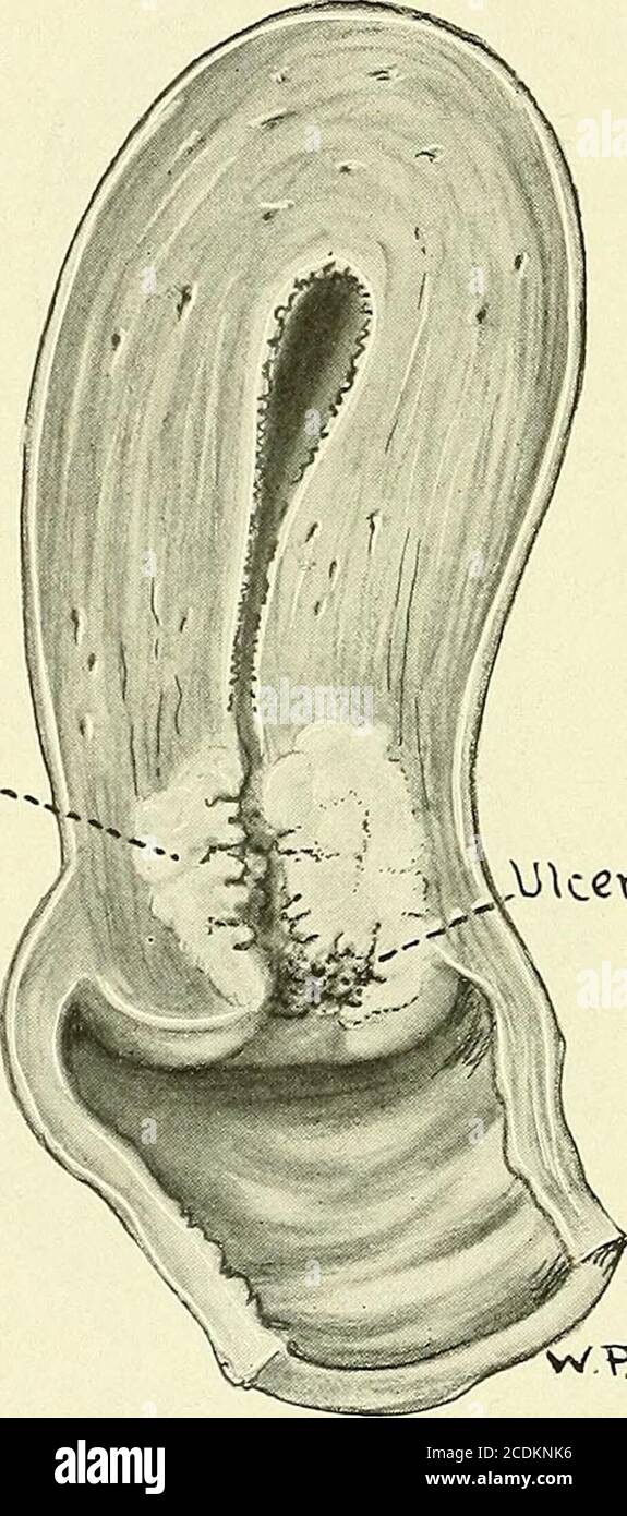 . Gynécologie : . l'endocol et les glandes arborescentes qui se ...