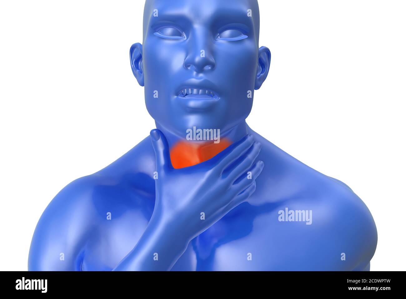 Cancer de la gorge Banque de photographies et d’images à haute ...