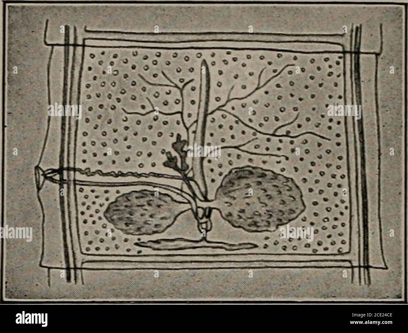 Taenia solium proglottids Banque de photographies et d’images à haute ...