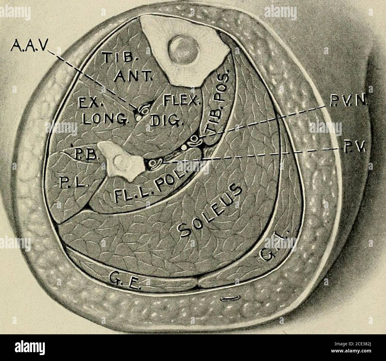 Nerf interosseux antérieur Banque de photographies et d’images à haute ...