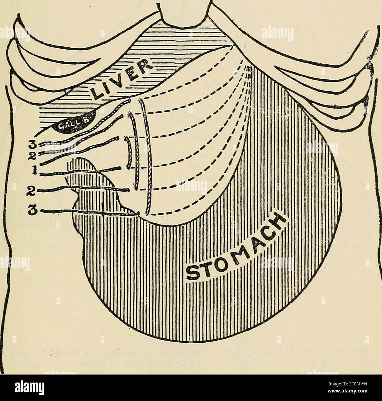 . Chirurgie opératoire, pour les étudiants et les praticiens . Figure ...