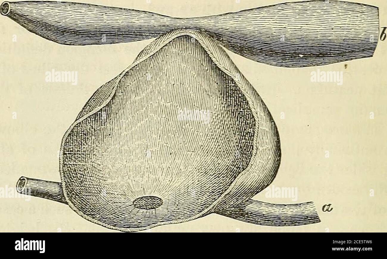 . Pathologie chirurgicale générale et thérapeutique, dans cinquante et ...