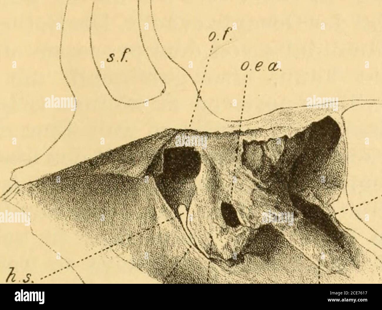 Sinus sphénoïdal Banque de photographies et d’images à haute résolution ...
