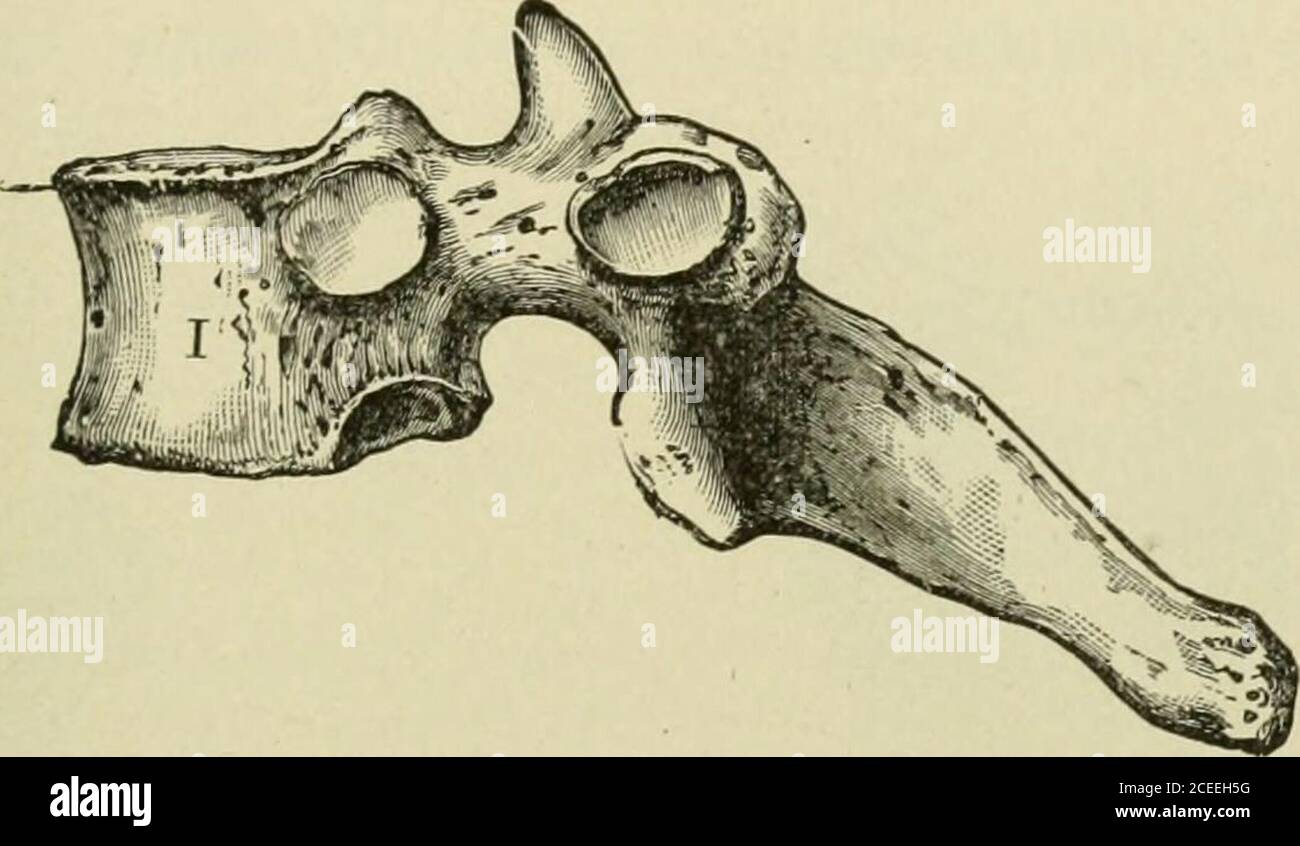Odontoid process Banque de photographies et d’images à haute résolution ...