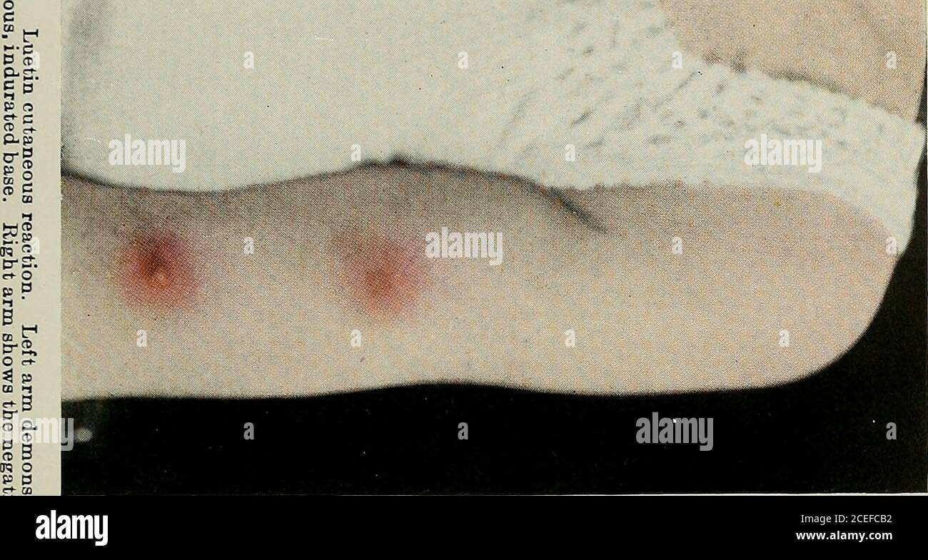 . Immunologie appliquée : l'application pratique de sérums et de ...