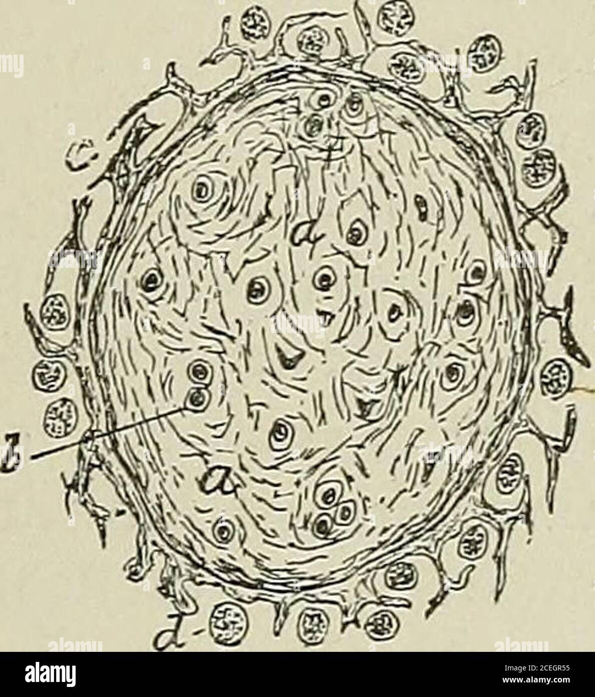 Section de la rate Banque de photographies et d’images à haute ...