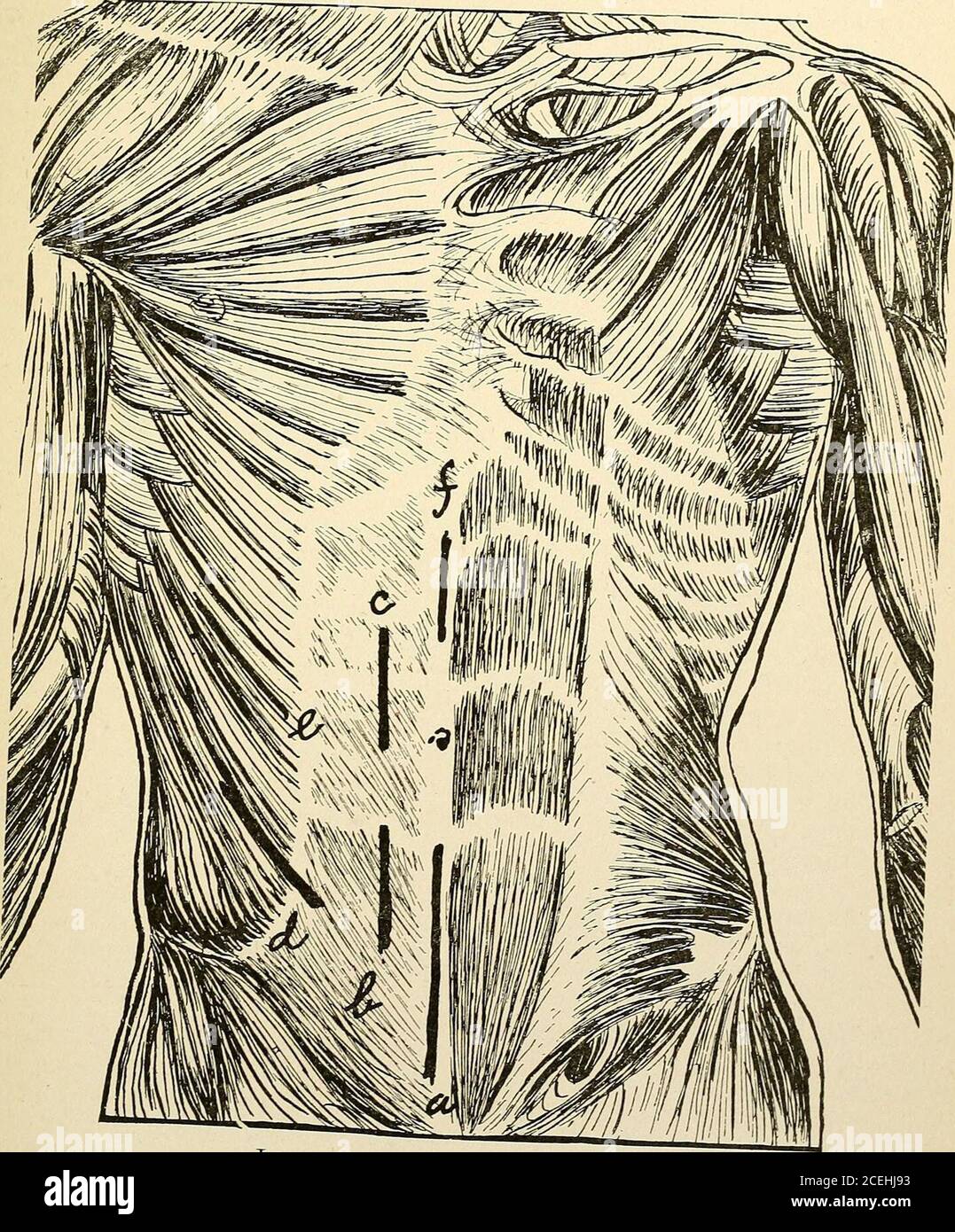 Incisions obliques Banque de photographies et d’images à haute ...