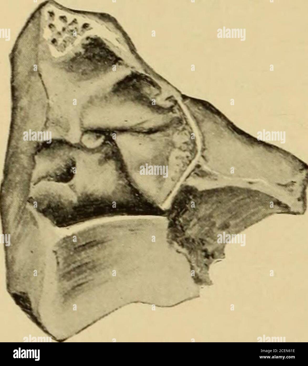Squamous suture Banque de photographies et d’images à haute résolution ...