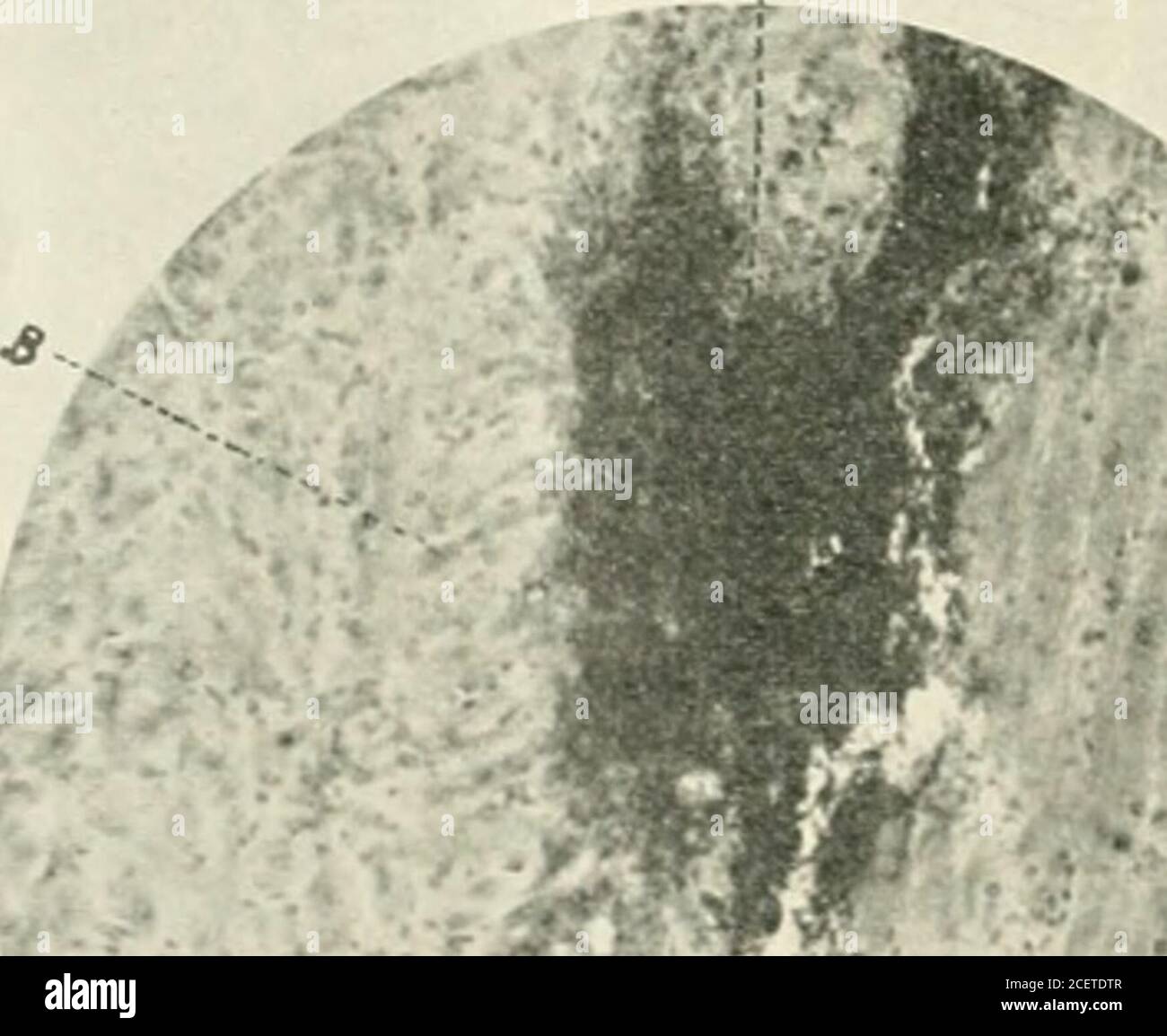 . Revue américaine d'obstétrique et de gynécologie. FLG. 1.—xl53 ...