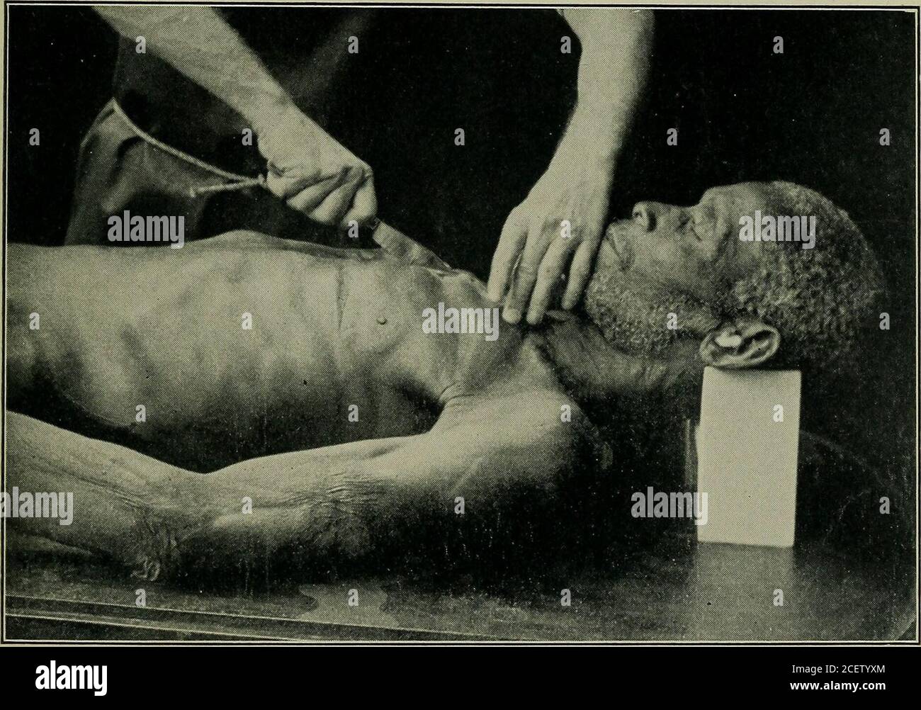 . Pathologie post-mortem; un manuel de la technique des examens post-mortem et les ...