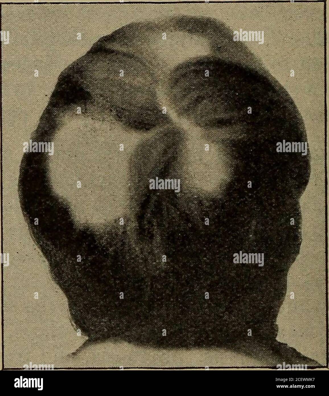 . Le manuel de référence des maladies de la peau. Alopécie ; (FR ...