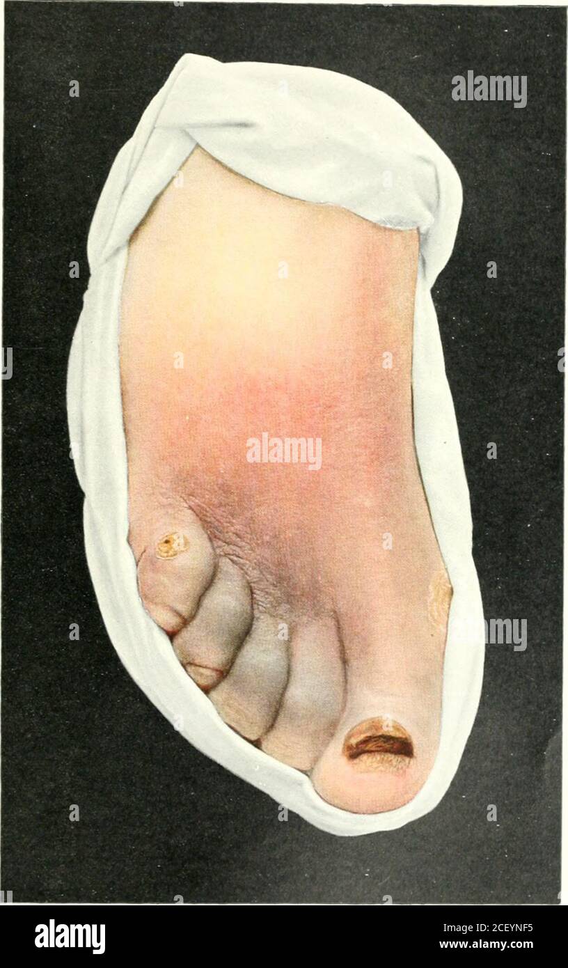 . Atlas de chirurgie clinique; avec une référence spéciale au ...