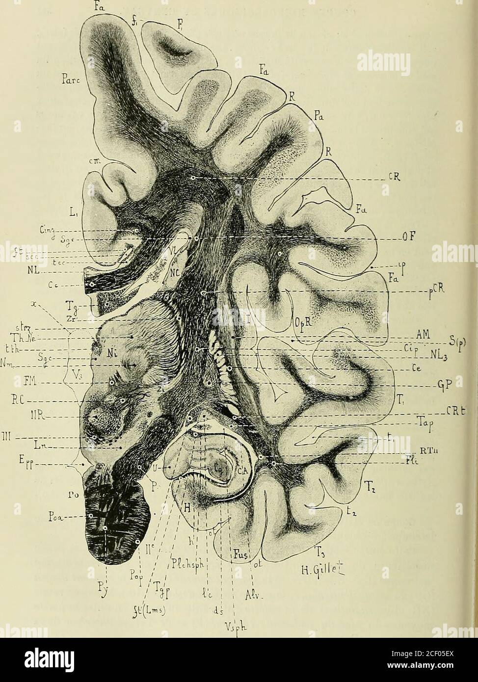 . Anatomie des centres nerveux. Pédoncule cérébral ( J. Dejerine ...