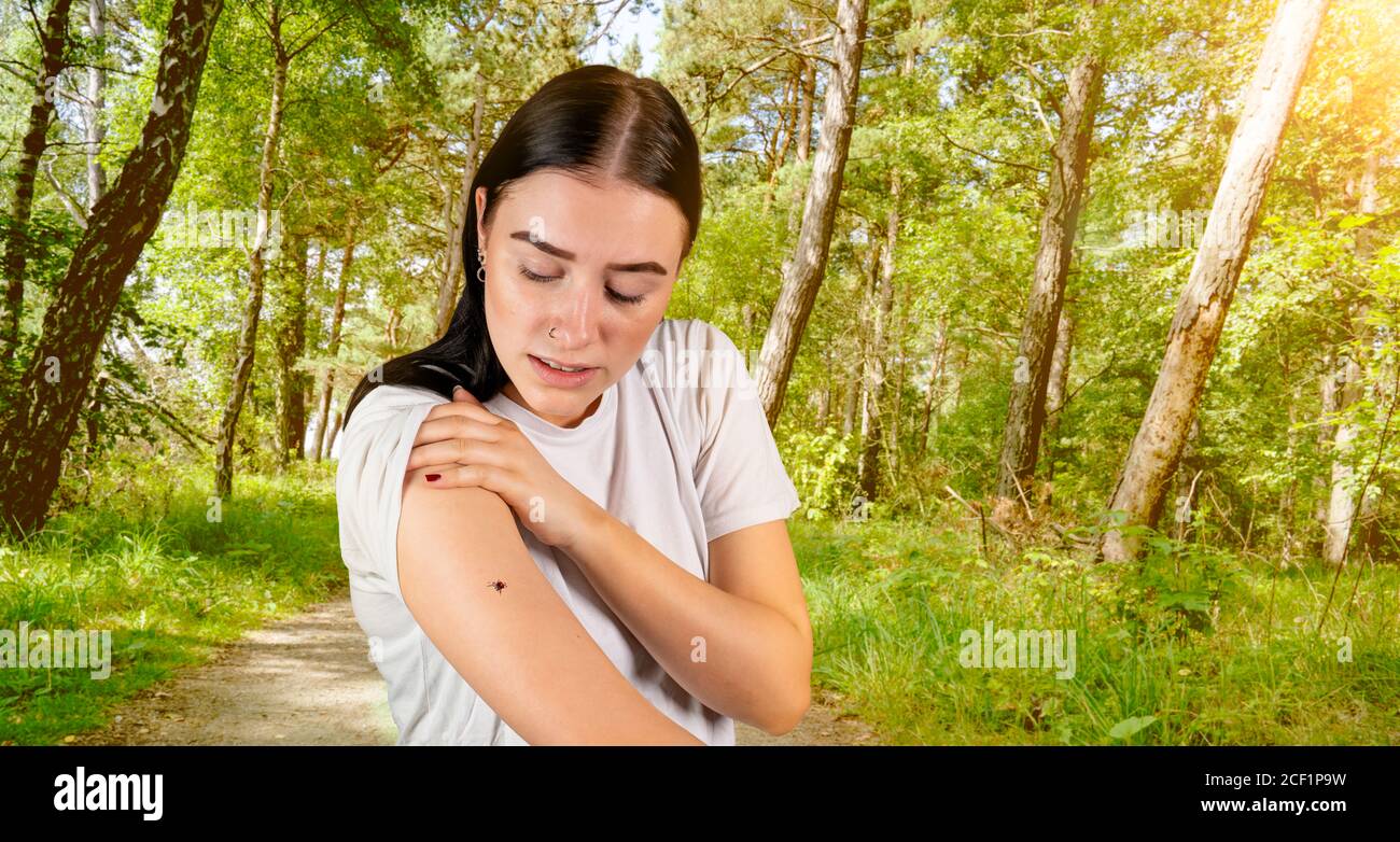 Morsure de tique sur le bras Banque de photographies et d’images à ...