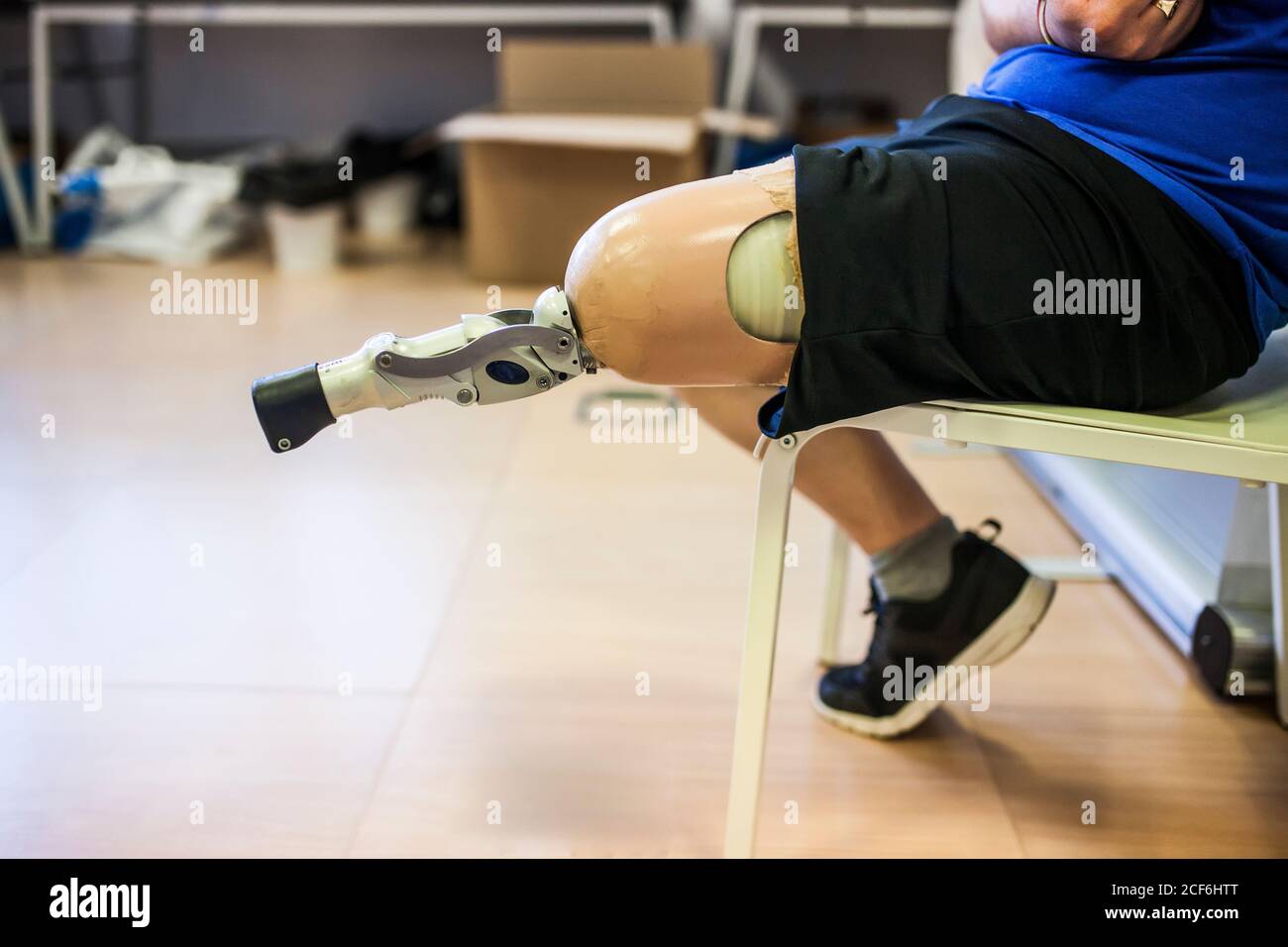 jeune homme amputé testant la nouvelle prothèse de jambe Photo Stock ...