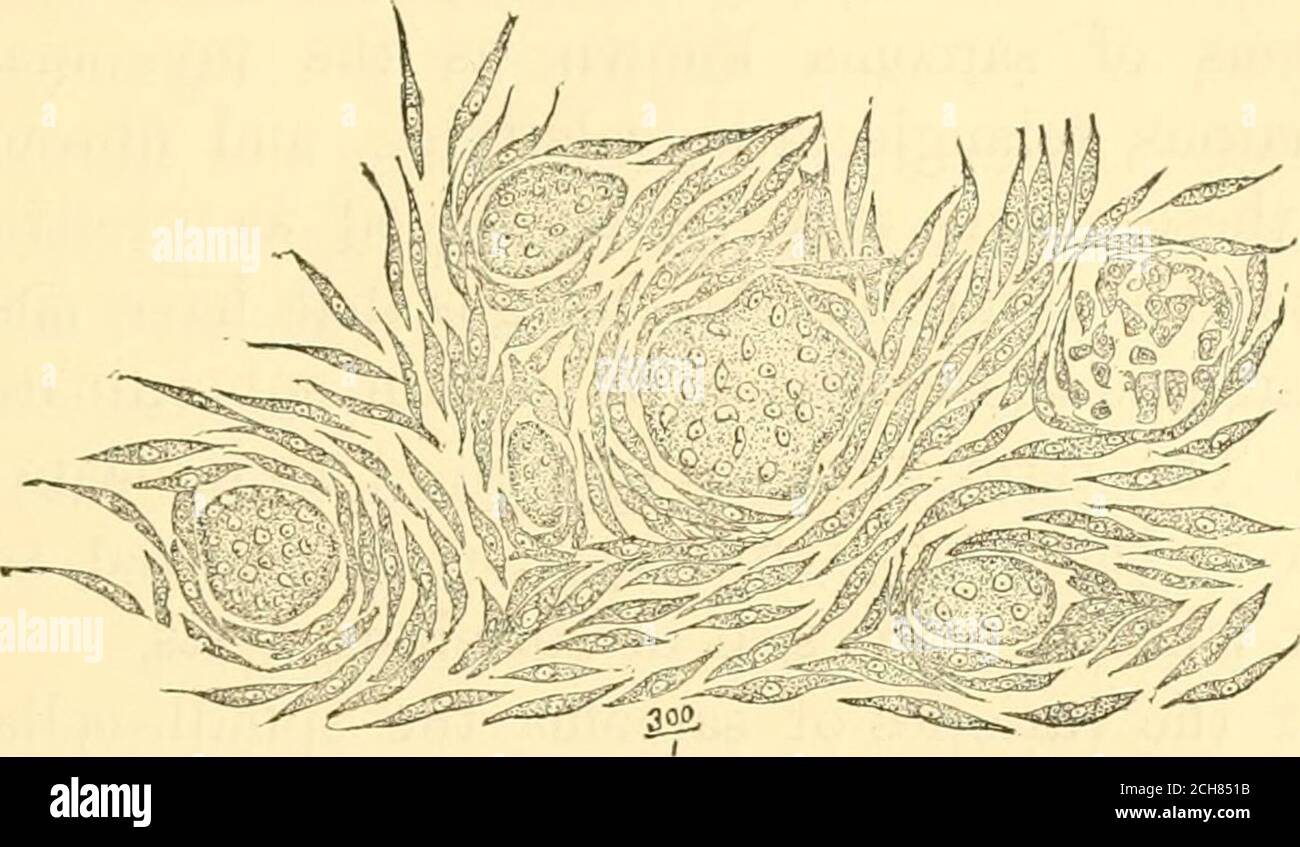 . Un traité pratique sur les tumeurs de la glande mammaire: . prises de ...