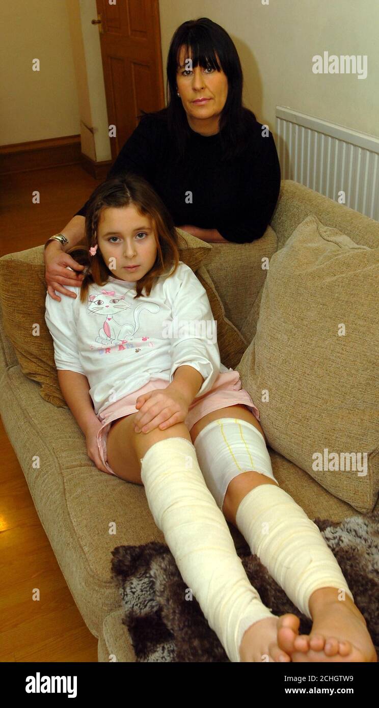 Ellie Fitzgerald, âgée de 10 ans, récupère à la maison, avec sa mère ...