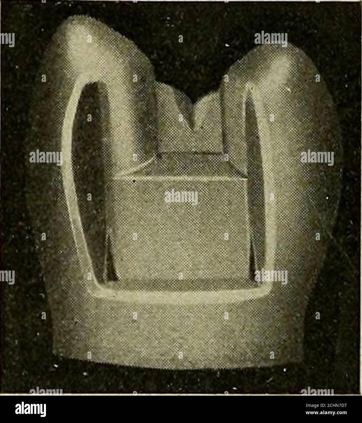 Surfaces occlusales Banque de photographies et d’images à haute ...