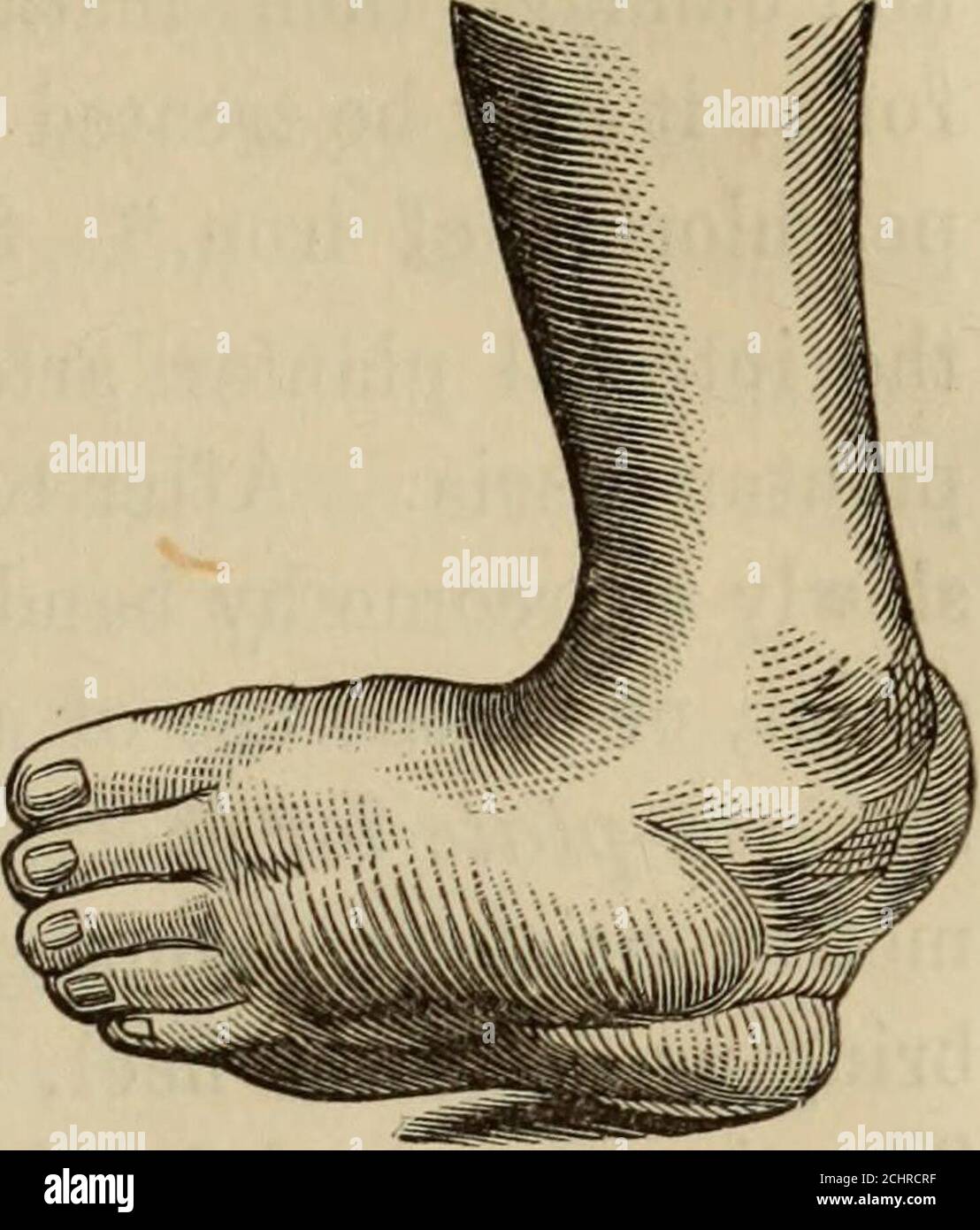 . La science et l'art de la chirurgie, englobant la chirurgie mineure ...