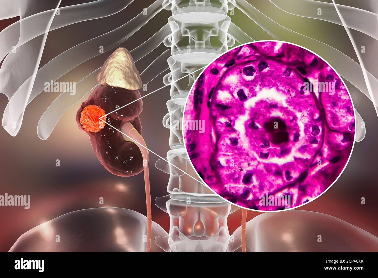 Micrographie et illustration Banque de photographies et d’images à ...