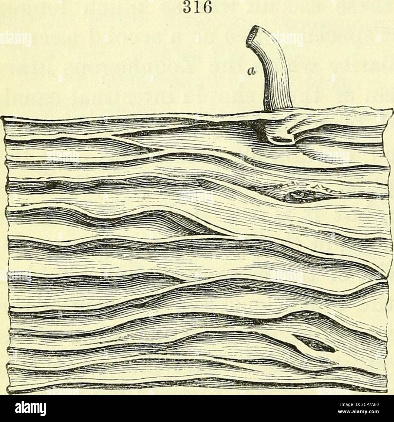 Anatomie du caecum Banque de photographies et d’images à haute ...