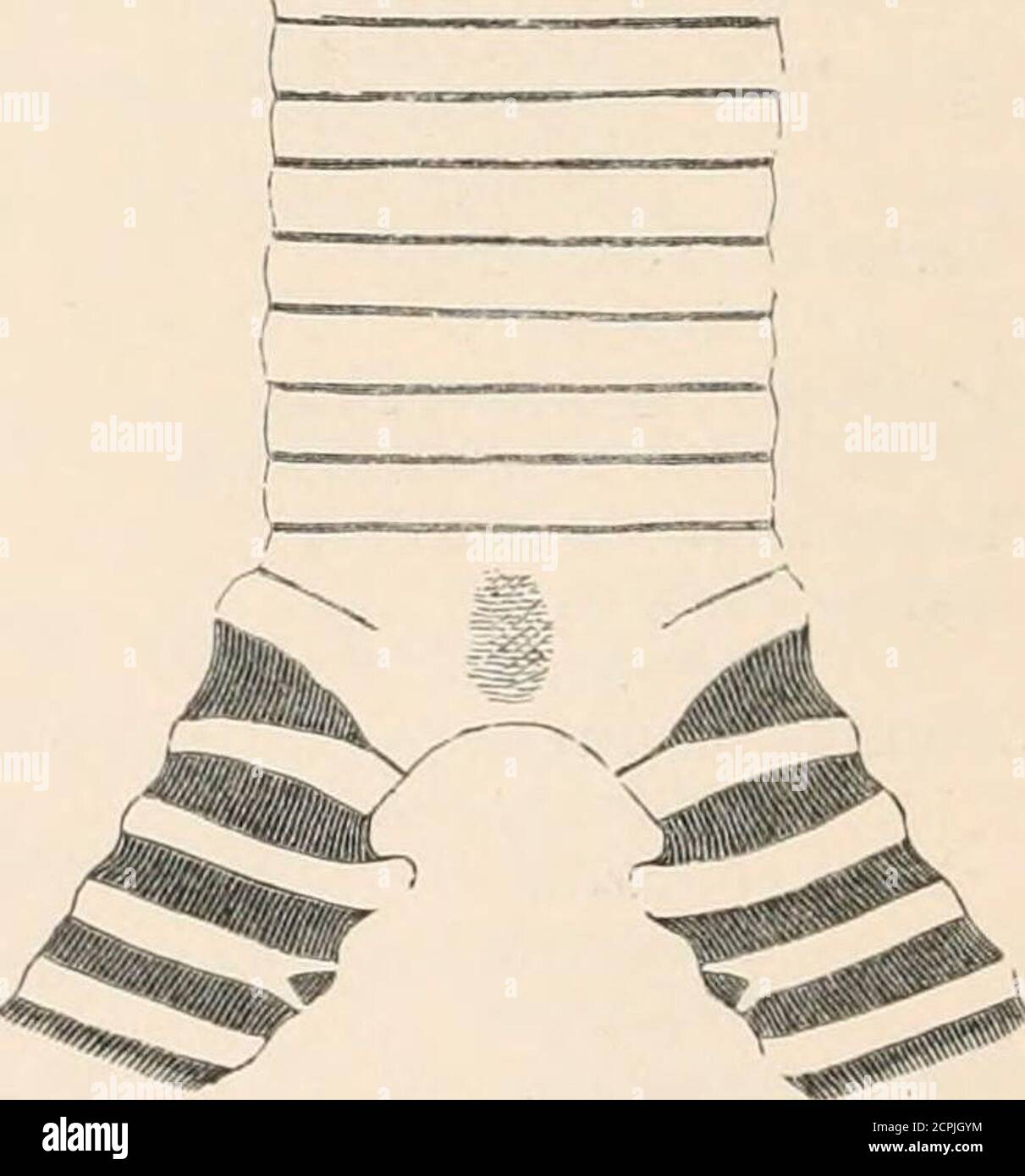 Carina trachea Banque de photographies et d’images à haute résolution ...