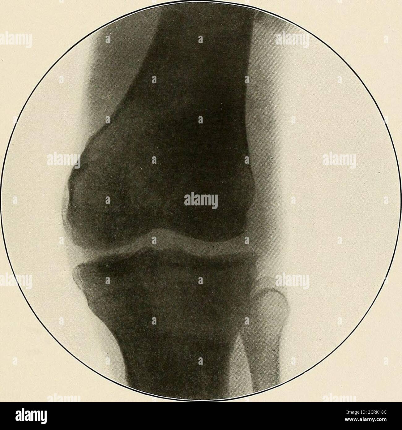 . Un atlas radiographique des changements pathologiques des os et des ...