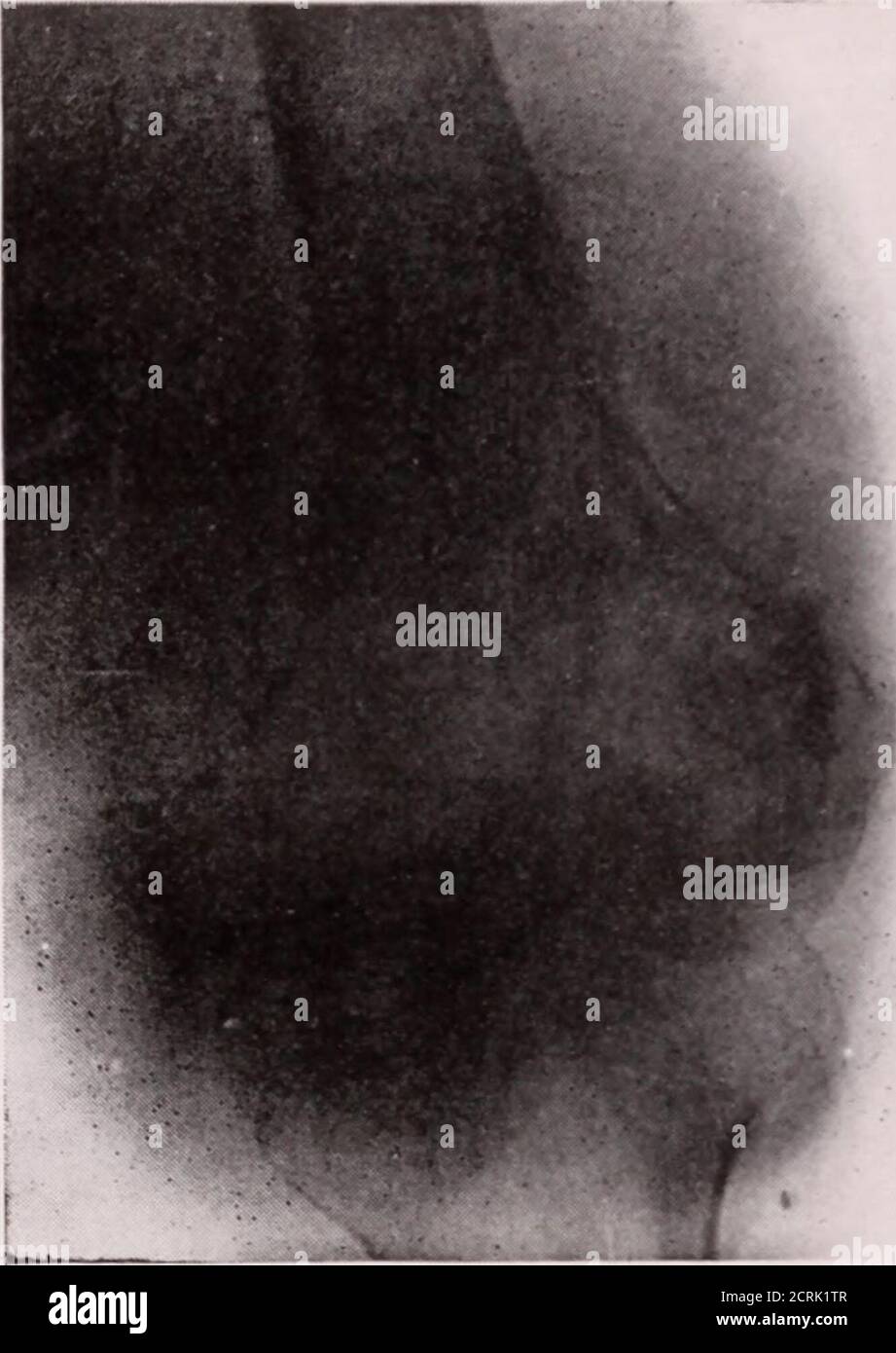 Medial condyle Banque de photographies et d’images à haute résolution ...