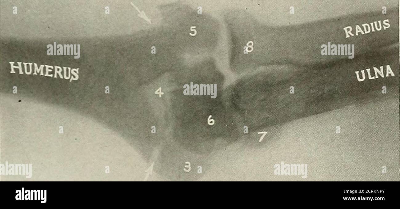 . Röntgen rayons et électrothérapeutiques : avec des chapitres sur le ...