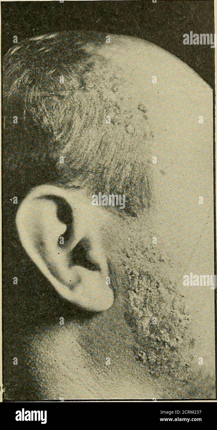 . Radiothérapie et photothérapie : y compris les courants de radium et ...