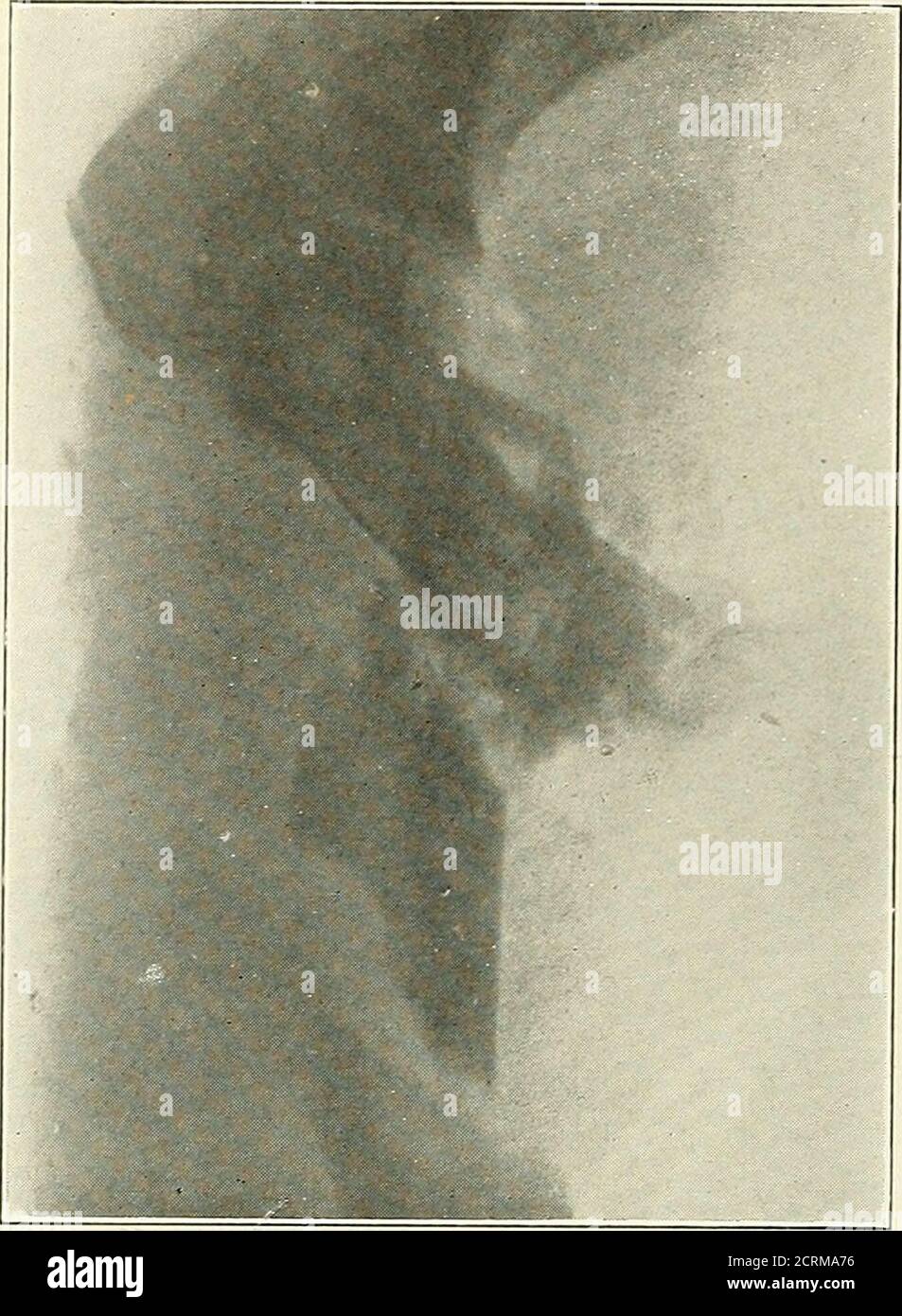. Roentgen interprétation; un manuel pour les étudiants et les ...