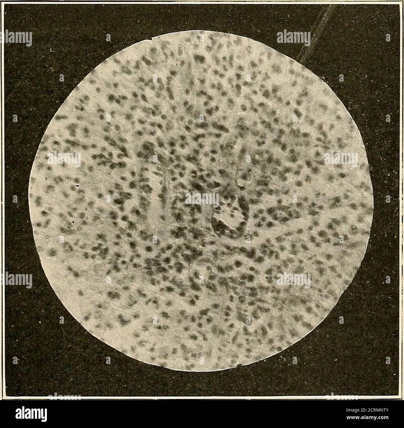 . Interprétation des roentogrammes dentaires et maxillaires . Figure 14 ...