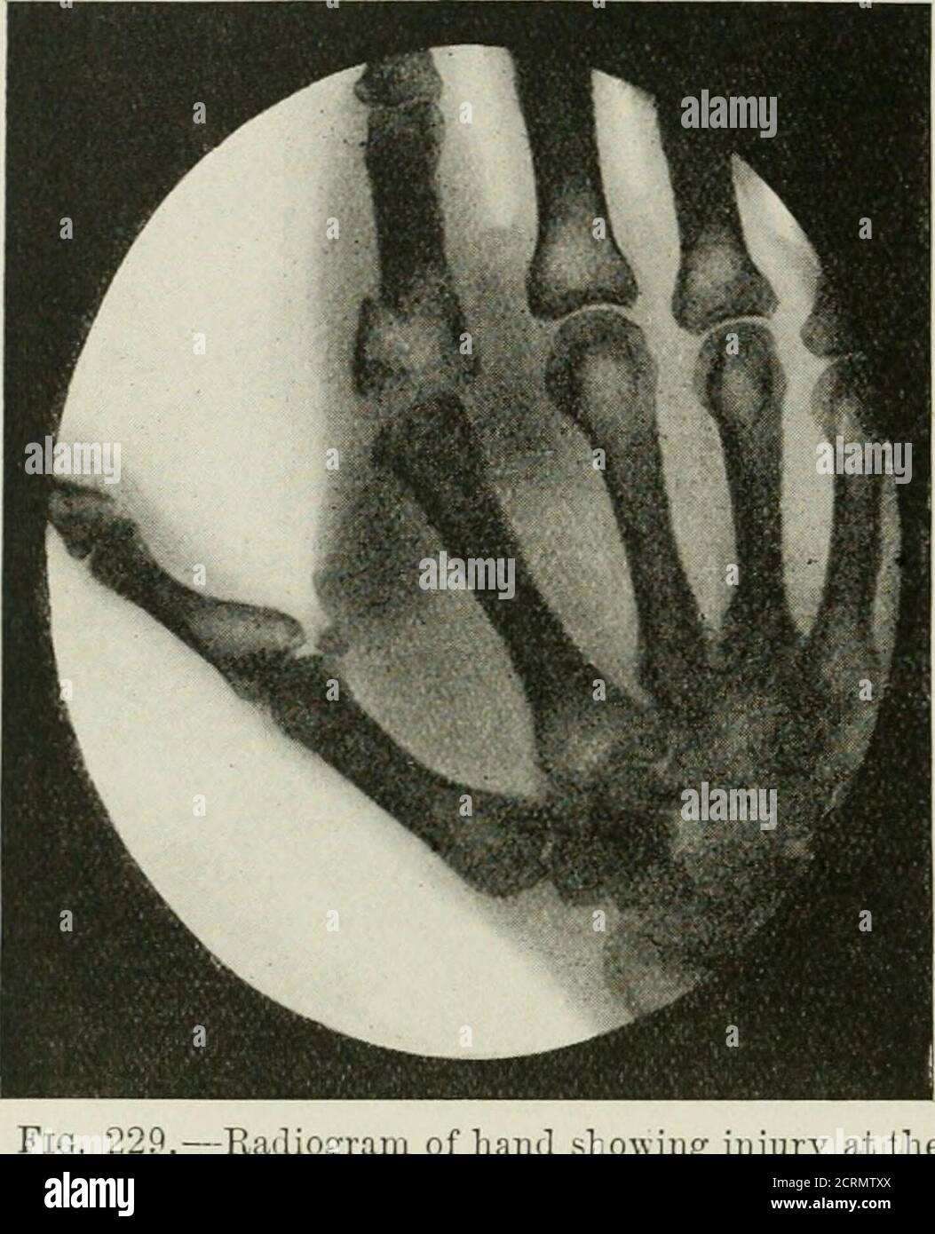 . Radiographie et radiothérapeutique . degré d'accompagnement de la ...