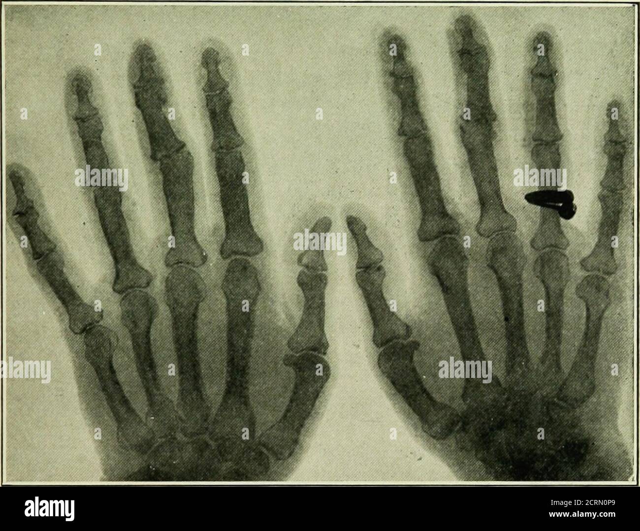 . Manuel des modes d'application électrostatiques, thérapeutiques, de ...