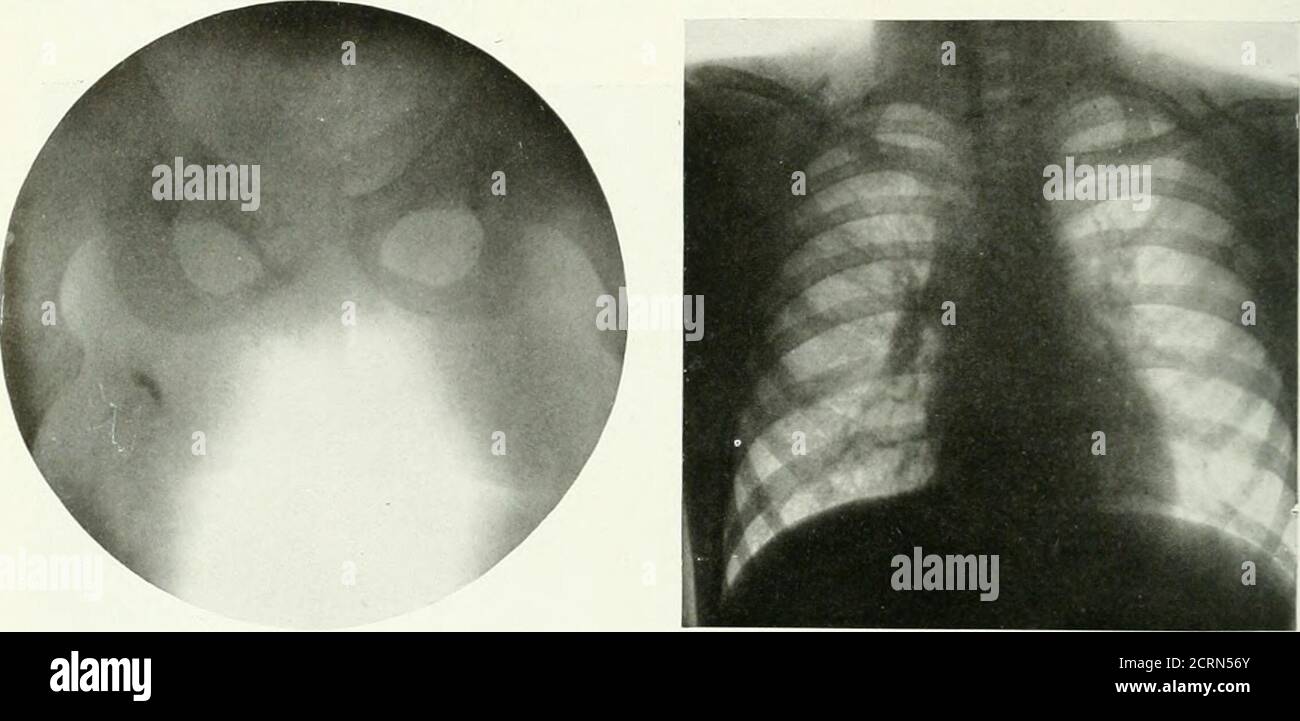 Ligaments symphyse pubienne Banque de photographies et d’images à haute ...