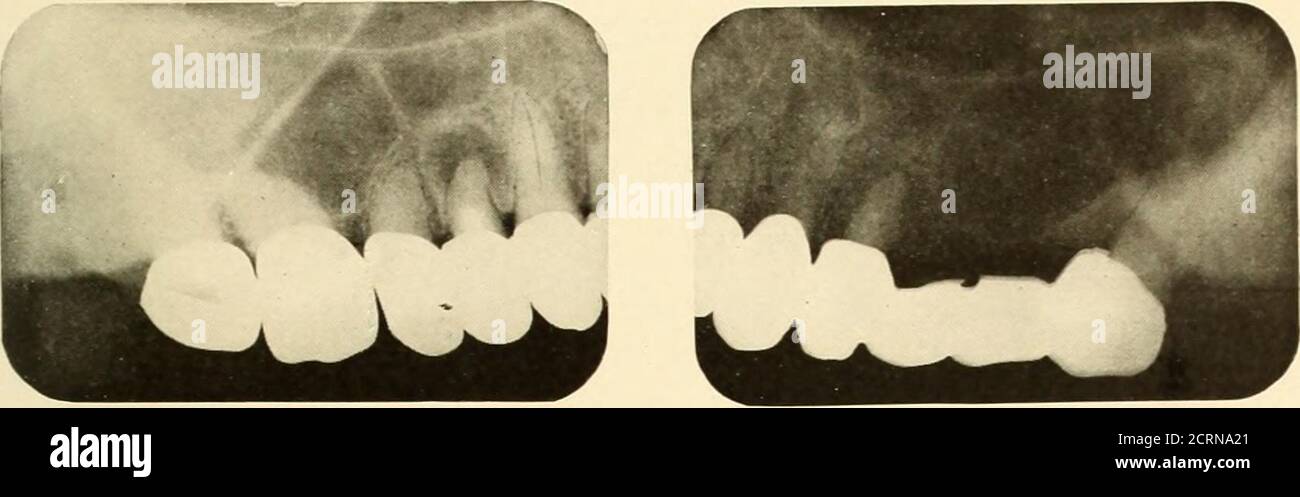 . Roentgoenologie orale : étude de Roentgen sur l'anatomie et la ...