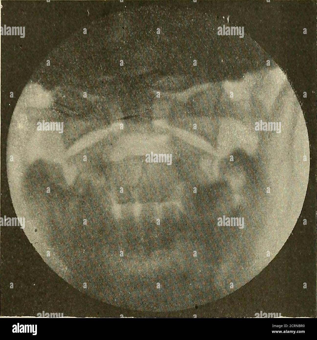 Odontoid process Banque de photographies et d’images à haute résolution ...