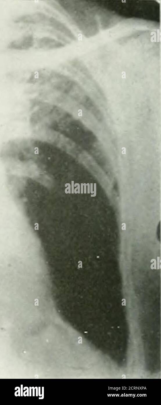 . La revue américaine de roentgoenologie, de radium thérapie et de ...