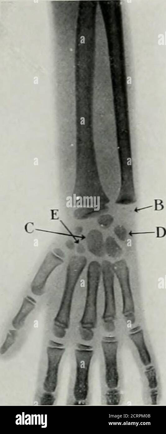. Anatomie et pathologie vivantes ; le diagnostic des maladies au début ...