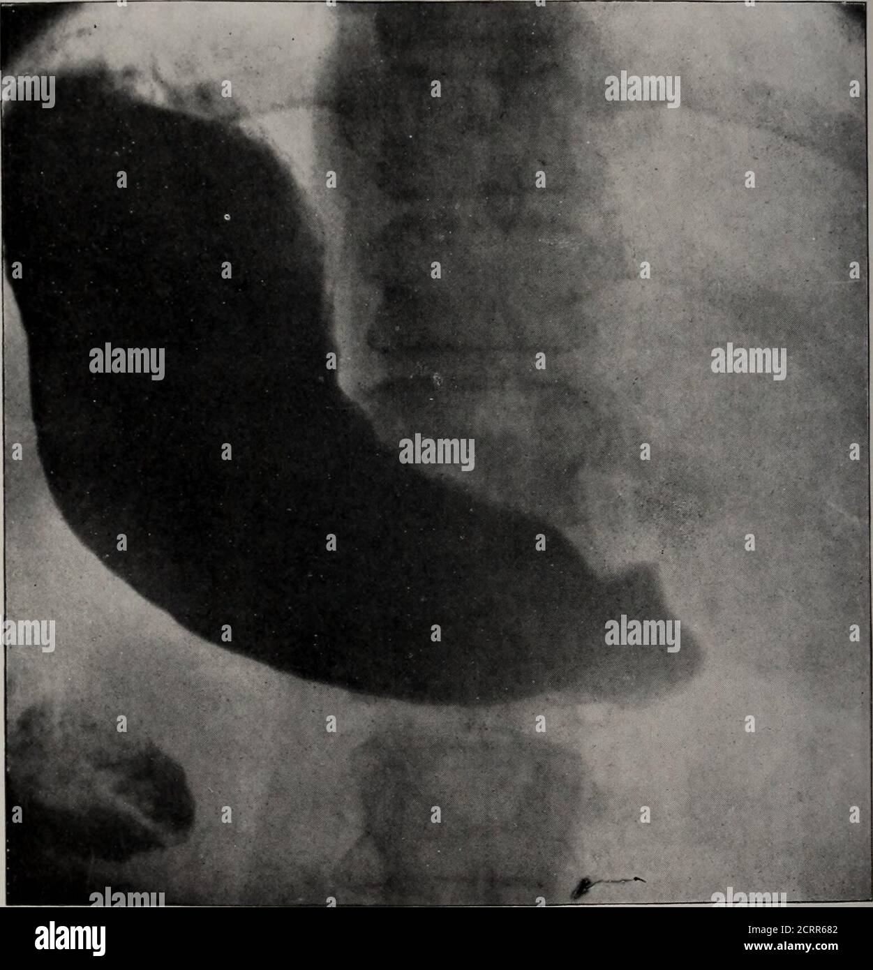 . Trimestre américain de roentgoenologie . Figure 1. Première partie ...