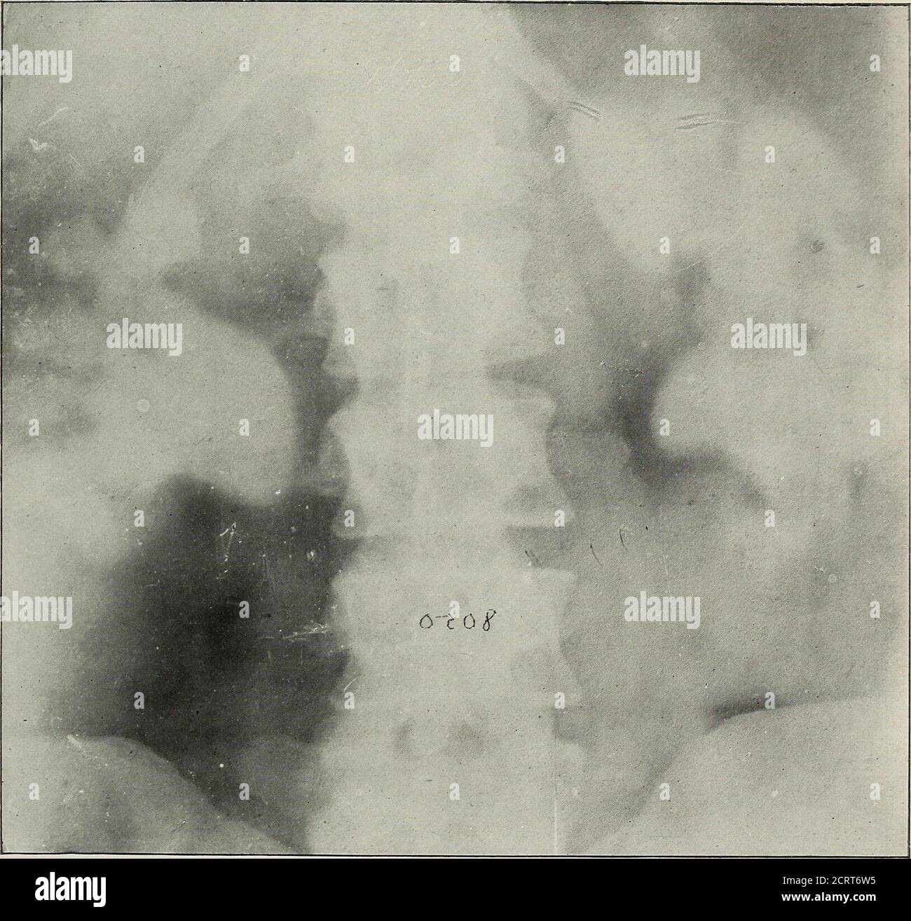 . Trimestre américain de roentgoenologie . O cd CDM d. Figure 4. Rayons ...