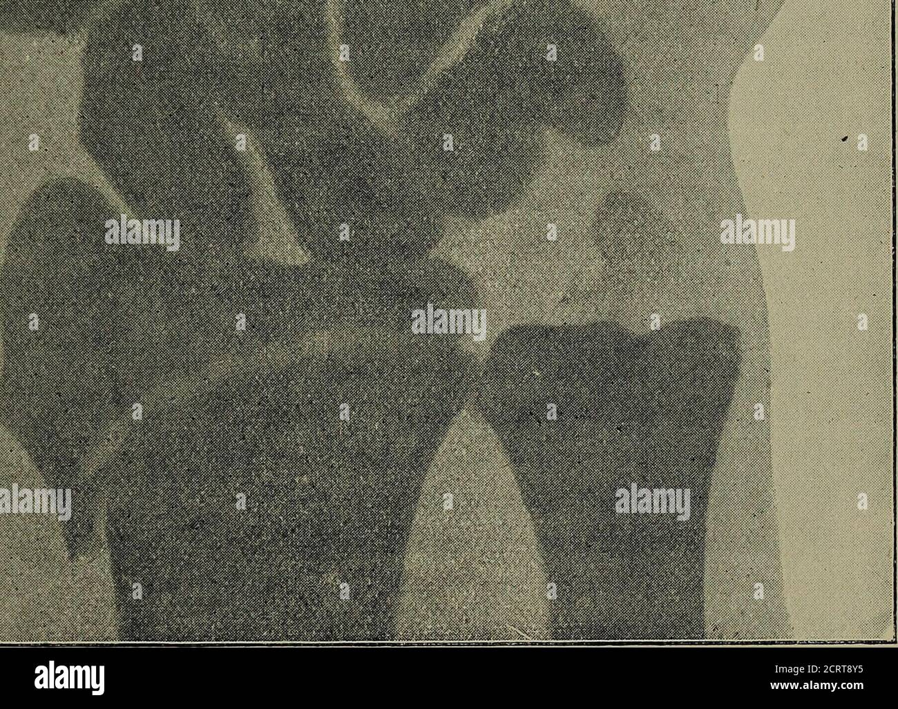 Processus styloïde Banque de photographies et d’images à haute ...