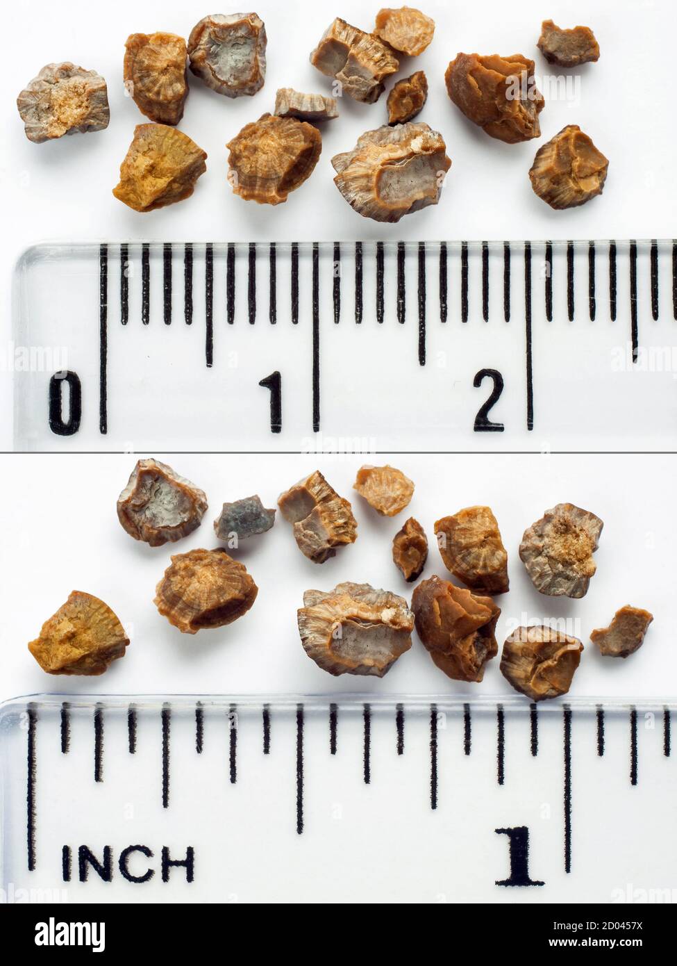 Pierre aux reins Banque de photographies et d’images à haute résolution ...