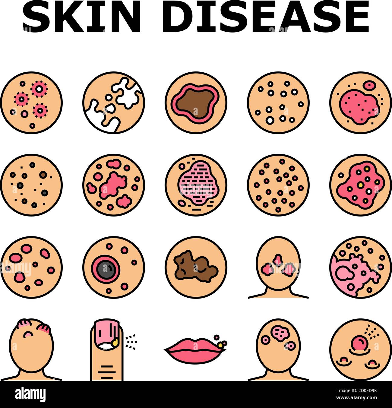 Maladies de la peau icônes de collection de symptômes définir le ...